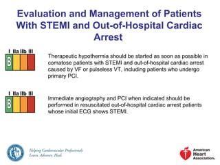 Stemi Ppt