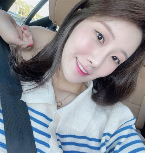 영식♥ 9기 영자 시술 고백 얼굴에 3일 멍…예뻐진다면 이 정도야 껌