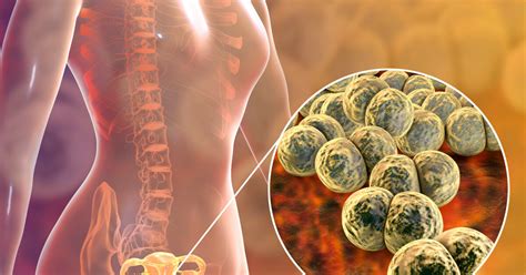 Kjønnssykdommer Slår Alarm Om Norsk Sex Vane