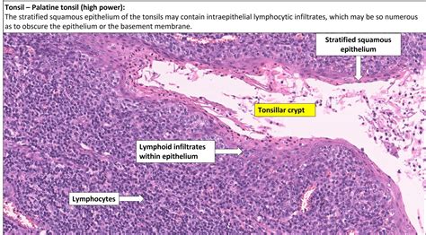 Tonsil Normal Histology Nus Pathweb Nus Pathweb