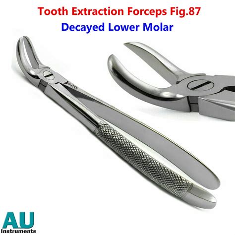 Lower Molar Extraction