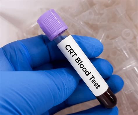 10 Clot Retraction Test Royalty Free Photos And Stock Images Shutterstock