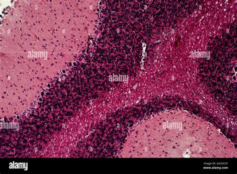 Cerebrum Light Micrograph Of A Section Through Part Of The Cerebrum Of The Brain Seen Here Are