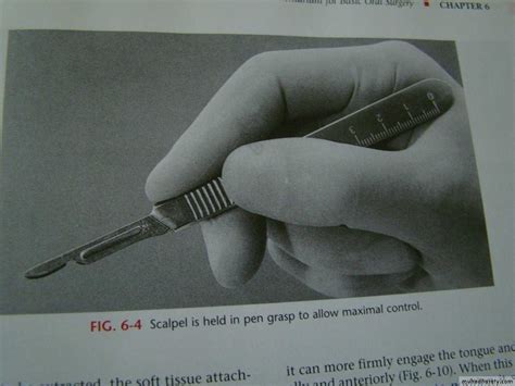 Surgical Removal Of Impacted Lower 3rd Molar Pptx د وسيم خالد Muhadharaty