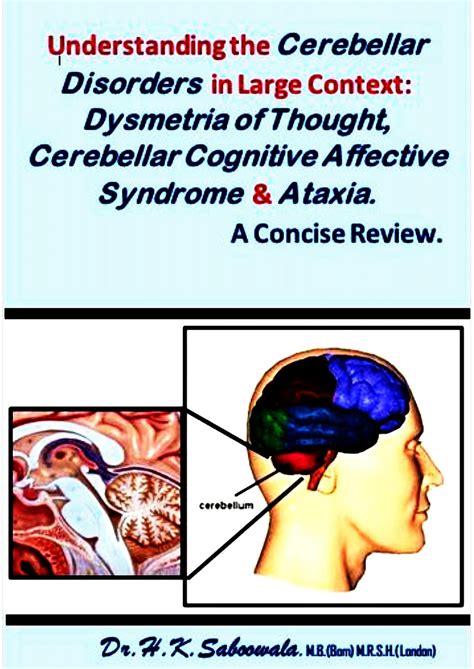 Understanding The Cerebellar Disorders In Large Context Dysmetria Of