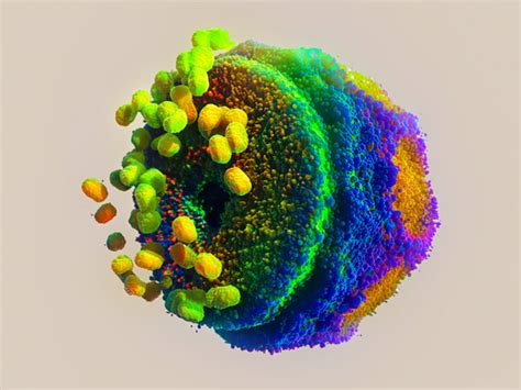 浆细胞骨髓瘤为什么会导致全身骨痛 浆细胞骨髓瘤 骨髓瘤 肿瘤疾病大全癌症肿瘤科普知识 有来医生