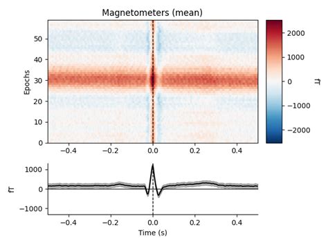 Overview Of Artifact Detection — Mne 1 4 0 Documentation