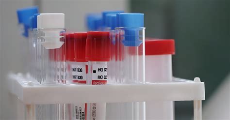 Загрязненные пестицидами поля обнаружили под Волгоградом Новости Mail