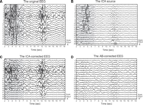 Figure 1 From Comparison Of Artifact Correction Methods For Infant Eeg Applied To Extraction Of