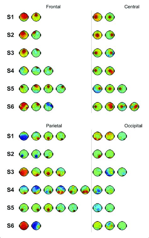 Scalp Maps Of Independent Components Categorized According To Area Of Download Scientific