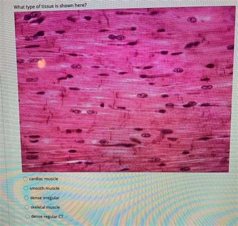 Solved What Type Of Tissue Is Shown Here Cardiac Muscle