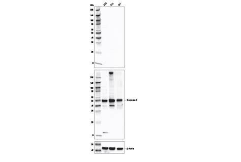 Cstcleaved Caspase 1 Asp296 E2g2i Rabbit Mab优宁维univ商城