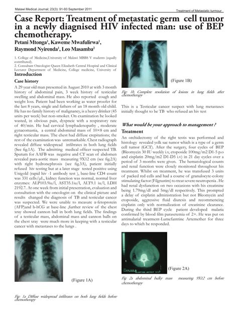 Pdf Case Report Treatment Of Metastatic Germ Cell Tumor In A Newly
