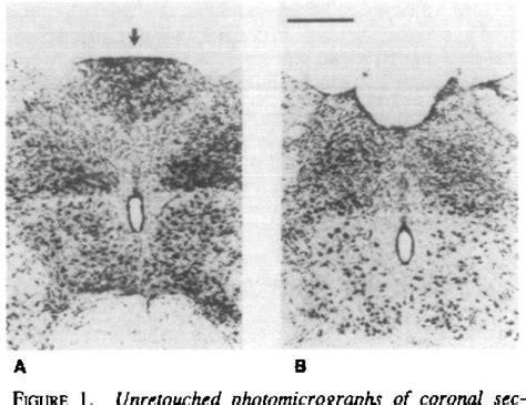 Figure 1 From Area Postrema Is Critical For Angiotensin Induced Hypertension In Rats Semantic
