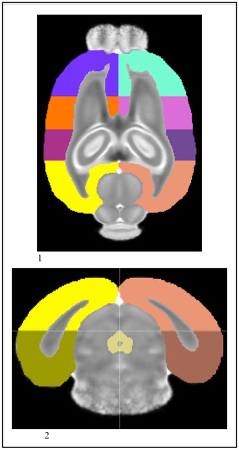 2 The P14 Cortex Divisions In The Md With The Central Gray Tan The Download Scientific