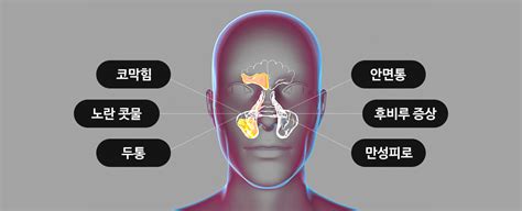 숨편한세상 한의원 비염 축농증부비동염