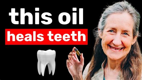 A Drop Of This Oil Heals Teeth And Kills Cavities Dr Barbara Oneill
