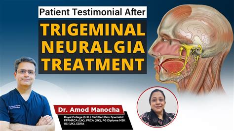 Treatment Of Trigeminal Neuralgia Patient Success Story Dr Amod Manocha Youtube