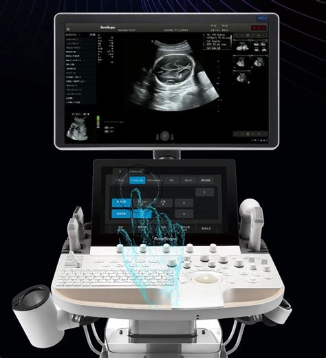 Sonoscapes S Fetus 40 Expands Access To Medtech News Sonoscape