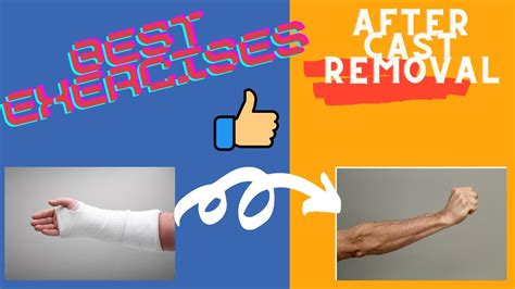 Broken Wrist Exercises Broken Finger Or Broken Thumb Symptoms