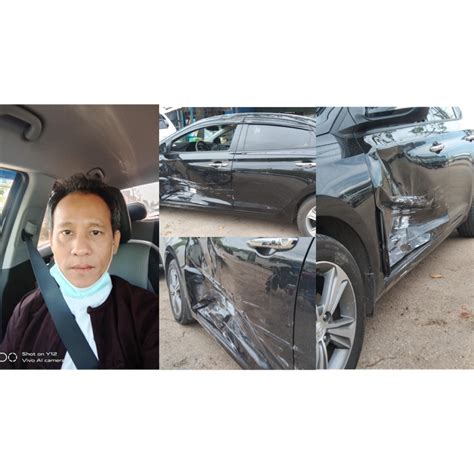 ယာဉ်မတော်တဆမှုကြောင့် ကားတစ်စီးလုံးနီးပါးပျက်ဆီးသွားခဲ့လို့ စိတ်ထိခိုက်ရကြောင်း ဖွင့်ဟလာခဲ့တဲ့