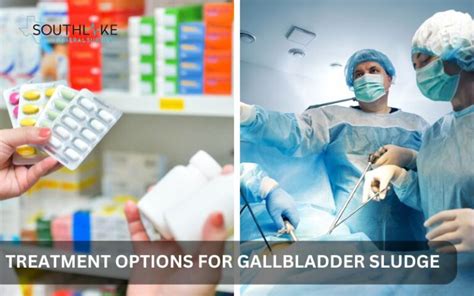 Gallbladder Sludge Symptoms And Treatments Explained Southlake General