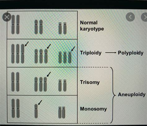 Monosomy Vs Trisomy