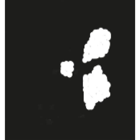Binarization Of Bleeding Area After Algorithm Segmentation A Fcrls Download Scientific