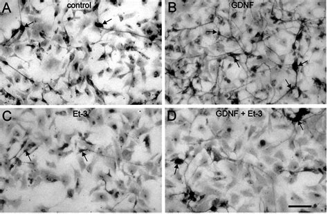 Dissociated Enteric Precursor Cells From E4 7 Quail Gut Grown For 4 Download Scientific Diagram