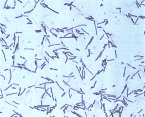 Bacillus Subtilis Junglekeyfr Image