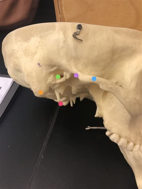 Temporal Bone Diagram Quizlet