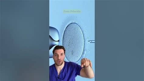 როგორ ხდება ხელოვნური განაყოფიერება მედიცინა სამედიცინო ექიმი Youtube