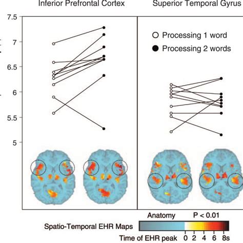 Main Brain Regions Involved In Language Processing Top Lateral View Download Scientific