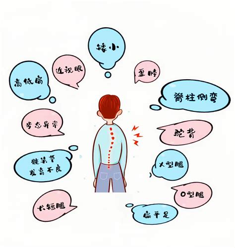 科普早期发现青少年脊柱侧弯尽早拍摄全脊柱X线片