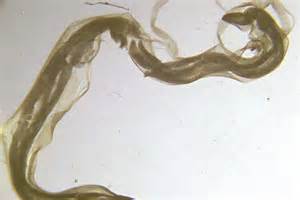 They Found Worms In 40 Year Old Canned Salmon—but Its Great News