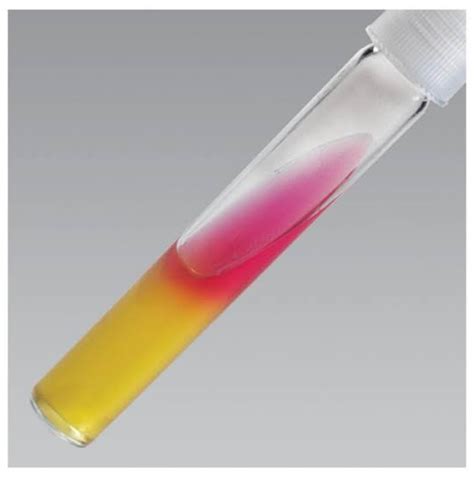 Hydrogen Sulfide H2S Test Principle Procedure Result Biology Notes Online