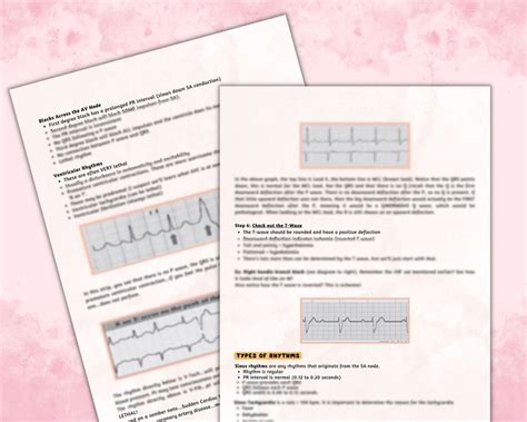 Ekg Study Guide Ekg Interpretation Ekg Rhythm Ekg Cheat Sheet