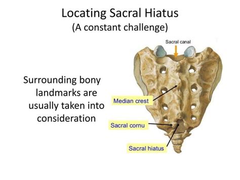 Anatomic Basis Of Epiduroscopy Pptx