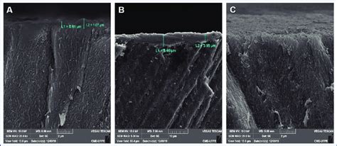 Representative Scanning Electron Micrographs Of The Enamel Cross Download Scientific Diagram