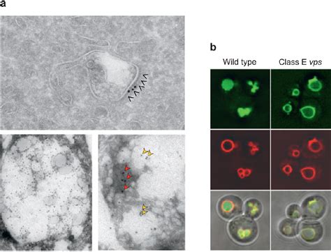 Figure 5 From Biogenesis And Function Of Multivesicular Bodies