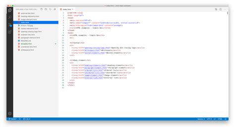 Why Should I Use Vs Code Simple Dev