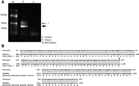 A Reverse Transcriptase Polymerase Chain Reaction Rt Pcr Download Scientific Diagram