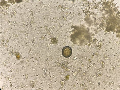 Teania Egg Human Parasite In Stool Stock Image Image Of Nature