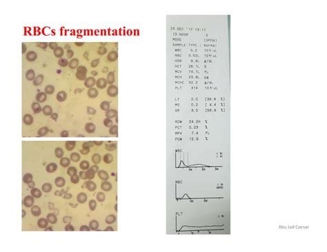 Rbc Histogram Pdf
