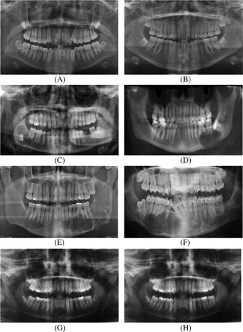 Classification Results Of The Modified Convolutional Neural Network