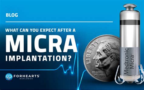 The Micra Leadless Pacemaker