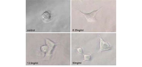 Neurite Outgrowth Of Pc12 Cells In The Presence Of Ngf At 24 H