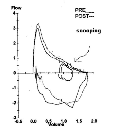 Pulmonary Function Test The Pulmonary Function Test Was Performed Download Scientific Diagram