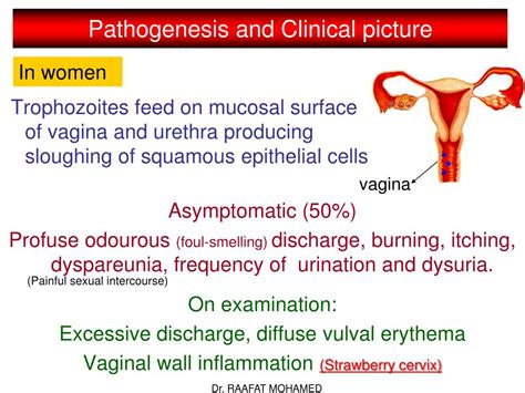 Ppt Trichomonas Vaginalis Powerpoint Presentation Free Download Id