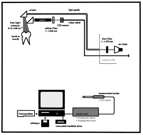 Quantitative Light Induced Fluorescence A Potential Tool For General Dental Assessment